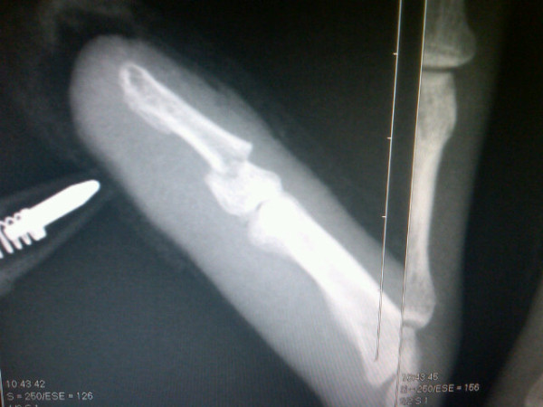 Mondy x-ray, Union record, Garfan for US, Libya has a new flag – The ...